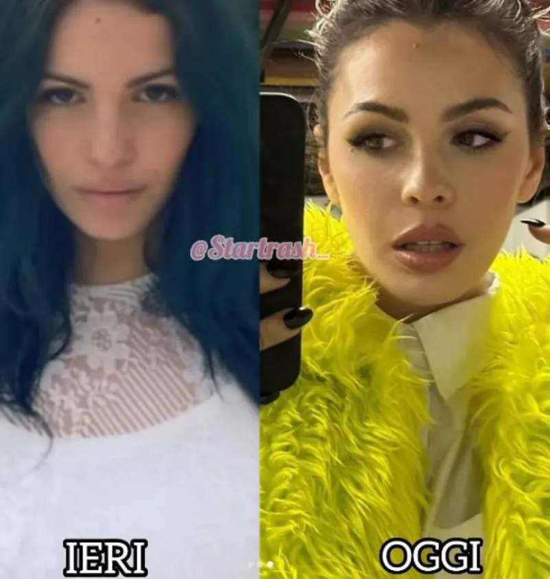 Rose Villain è rifatta? Le foto prima e dopo l'intervento al naso