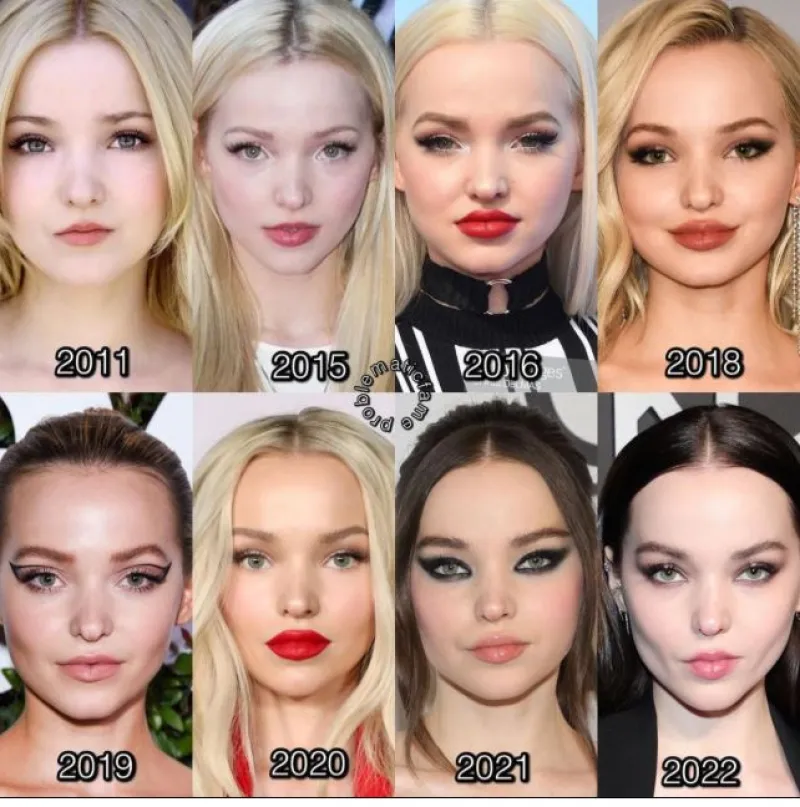 Dove Cameron prima della chirurgia estetica, un'altra persona