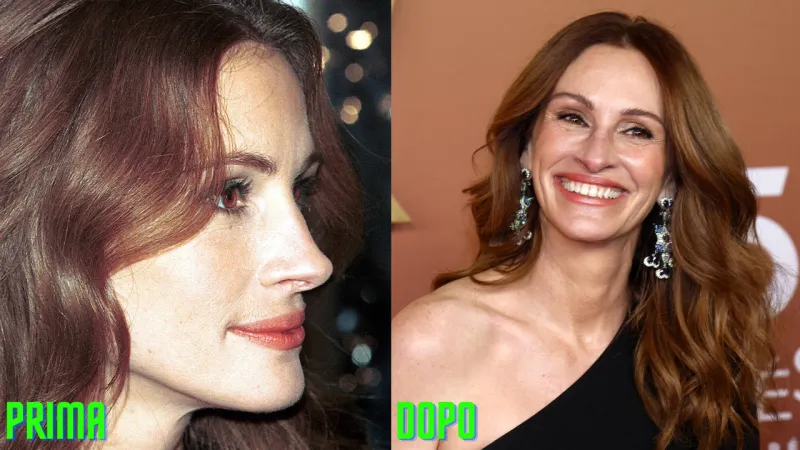 Julia Roberts è rifatta? La verità sul suo naso dalle foto prima e dopo