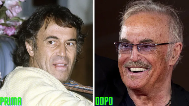 Franco Califano era rifatto? I rumors sul naso "schiacciato": le foto ...