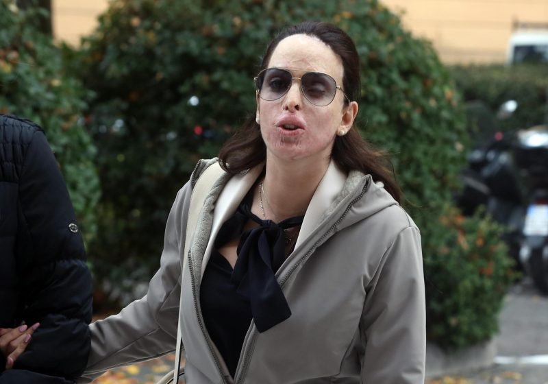 Gessica Notaro età, fidanzato, matrimonio, storia