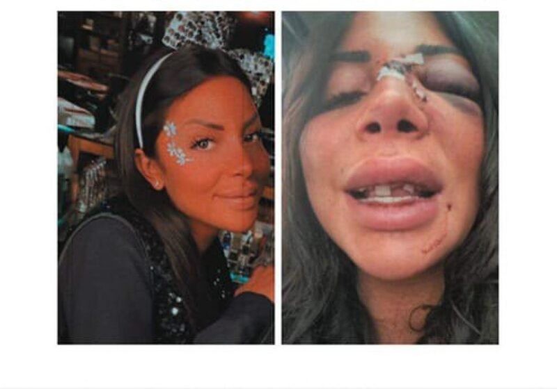 Martina Mucci ex fidanzato: le frasi choc contro la nuova compagna