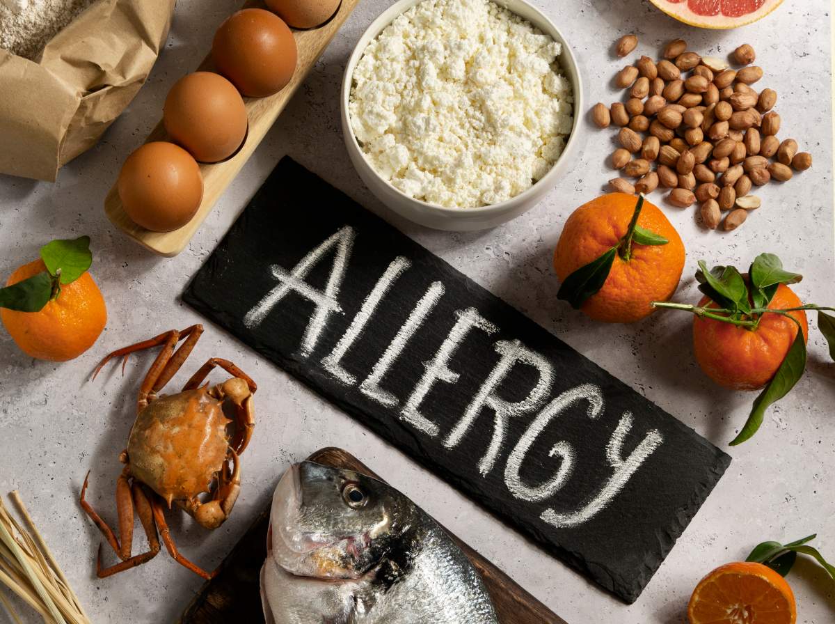 Allergia al nichel: quali sono gli alimenti che lo contengono, i si...