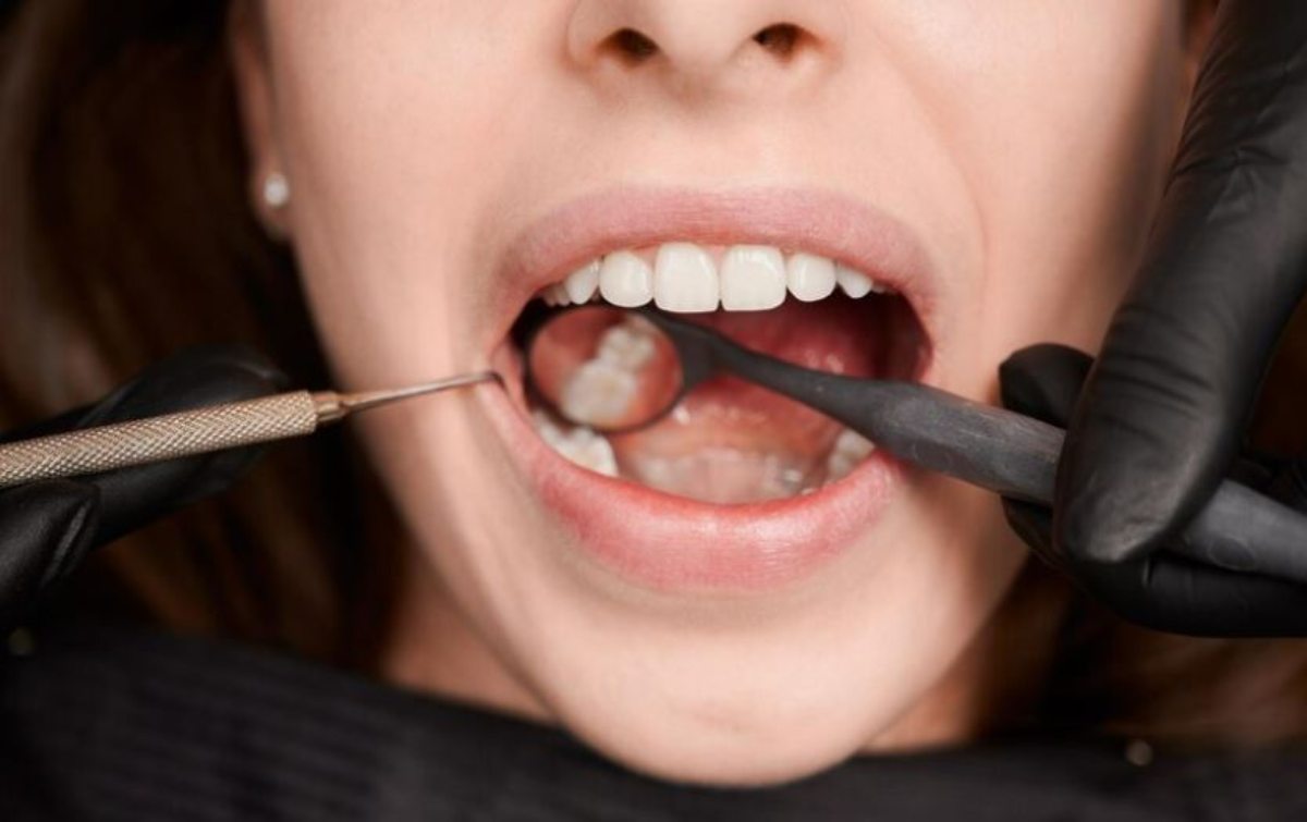 Quali alimenti macchiano i denti e cosa mangiare per avere denti più bianchi TAG24