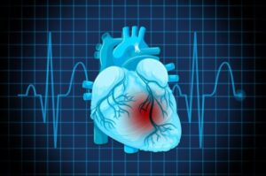 Quale attività fisica è adatta ai cardiopatici? Ecco come proteggere il ...