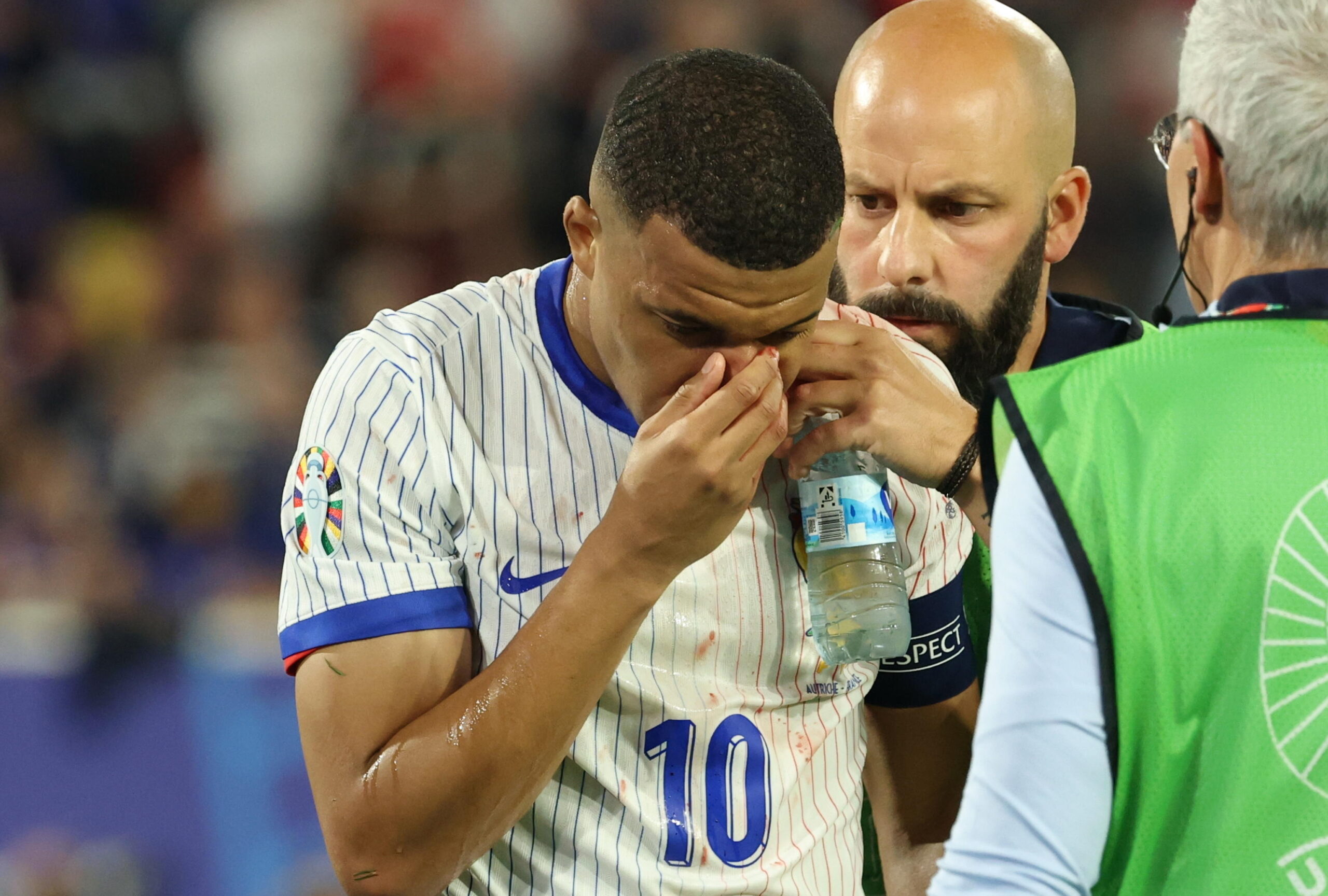 Mbappé, naso rotto ma niente intervento (per ora): quando torna e ...